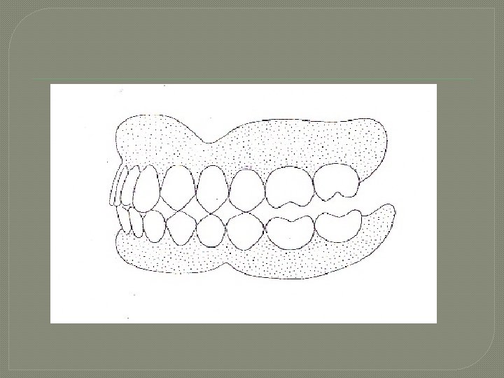Setting posterior teeth Dr Nesreen Salim Factors affecting