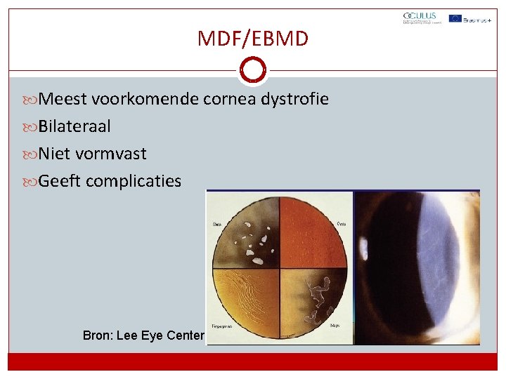 GOO1 OPOND 1 13 Beoordelen conjunctiva cornea en