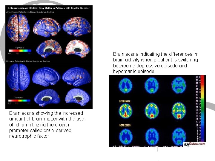 Treatment of Psychotic Disorders With a focus on