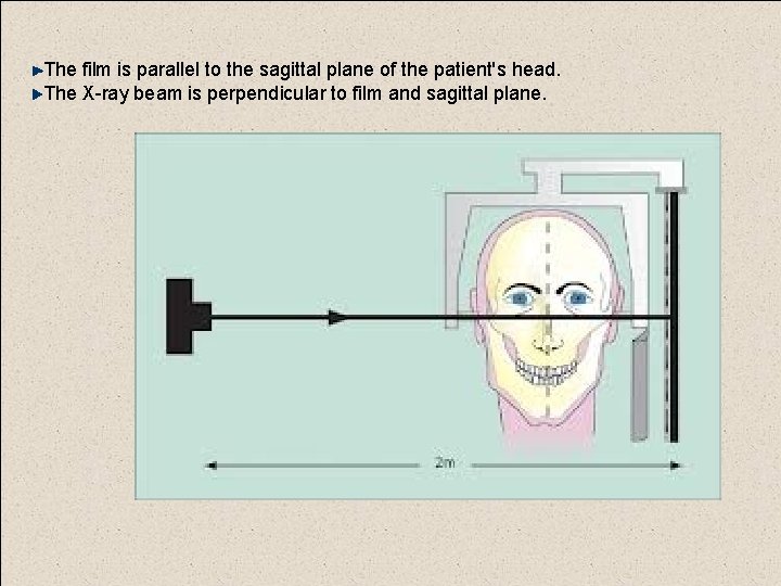 cephalometric radiograph is a diagnostic radiography as a