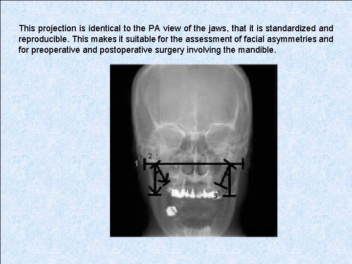 cephalometric radiograph is a diagnostic radiography as a