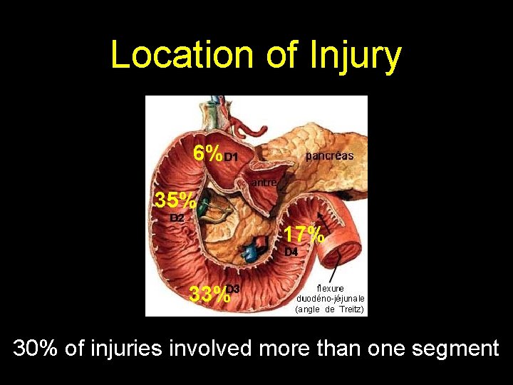 Management of Pancreatic and Duodenal Trauma 43 rd