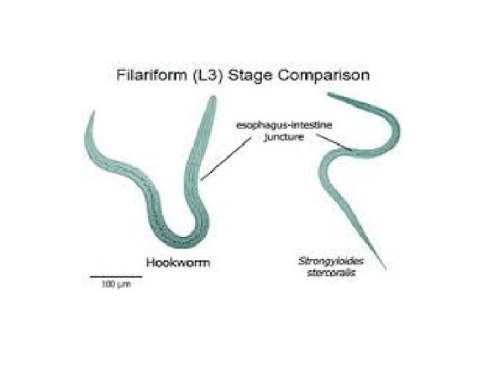 Trichostrongylus spp Strongyloides stercoralis Oleh Nurhalina M Epid