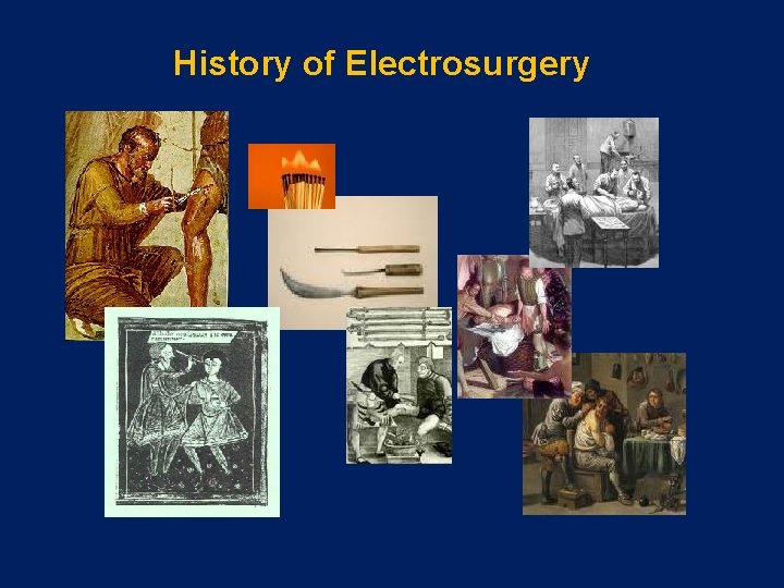 Use of Electrosurgery and Argon Plasma Coagulation Therapeutic