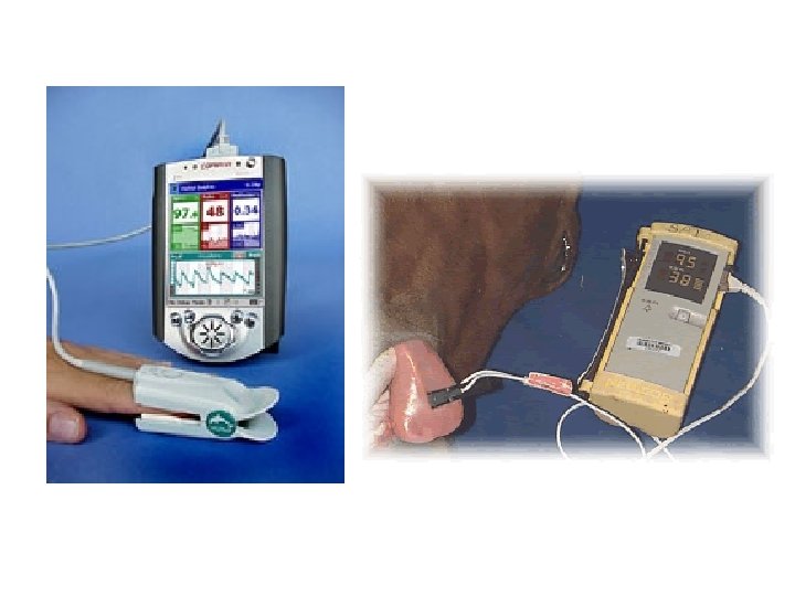 Intro to Procedures The Arterial Blood Gas Information