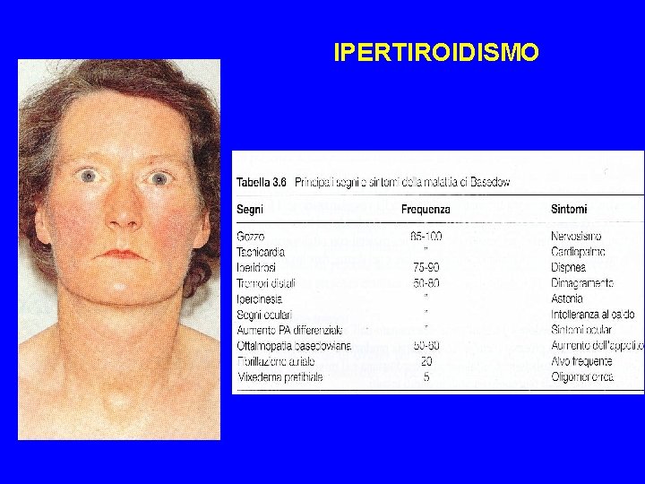 LA TIROIDE TIROIDE fisiologia TIROIDE fisiologia TIROIDE fisiologia