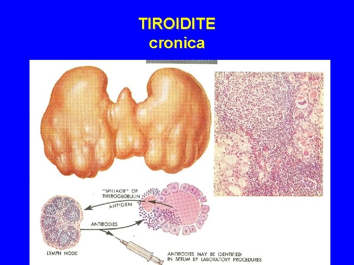 LA TIROIDE TIROIDE fisiologia TIROIDE fisiologia TIROIDE fisiologia