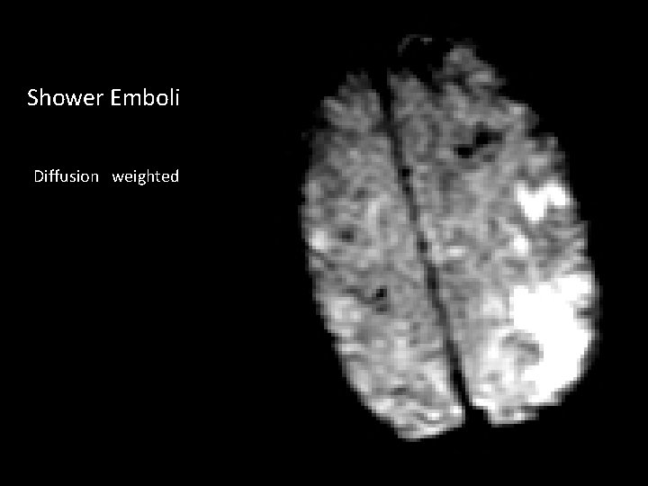 Basic Neurovascular Anatomy and Differences between the Arteries