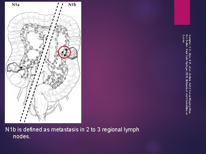 TNM Staging Colon and Rectum TONYA BRANDENBURG MHA