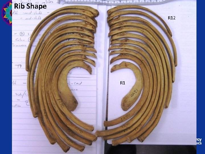 Biomechanics of the Immature Ribs and Vertebra 5
