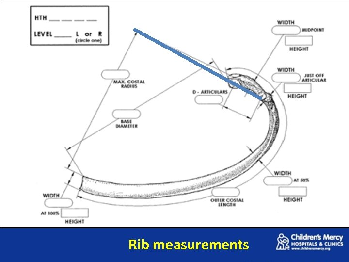 Biomechanics of the Immature Ribs and Vertebra 5