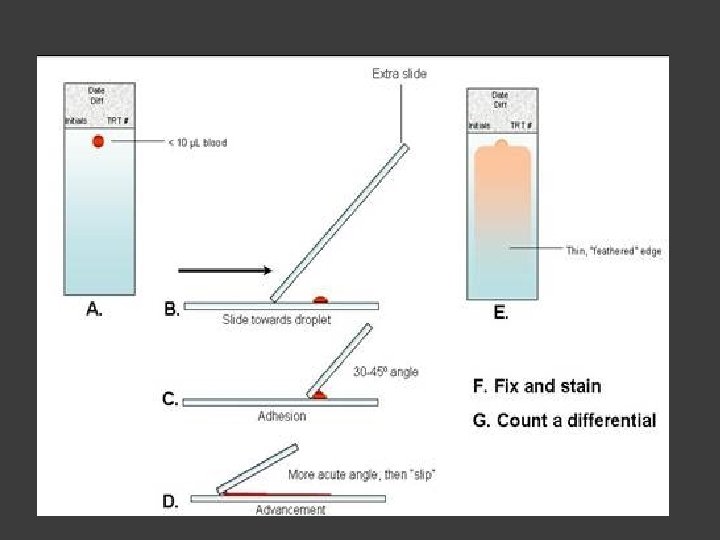Preparation of Staining examination of blood film we
