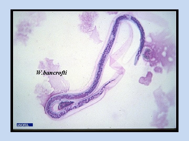 FILAIRES ET FILARIOSES Dr BENMEZDAD A Les filarioses