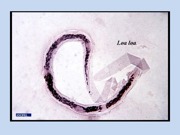 FILAIRES ET FILARIOSES Dr BENMEZDAD A Les filarioses