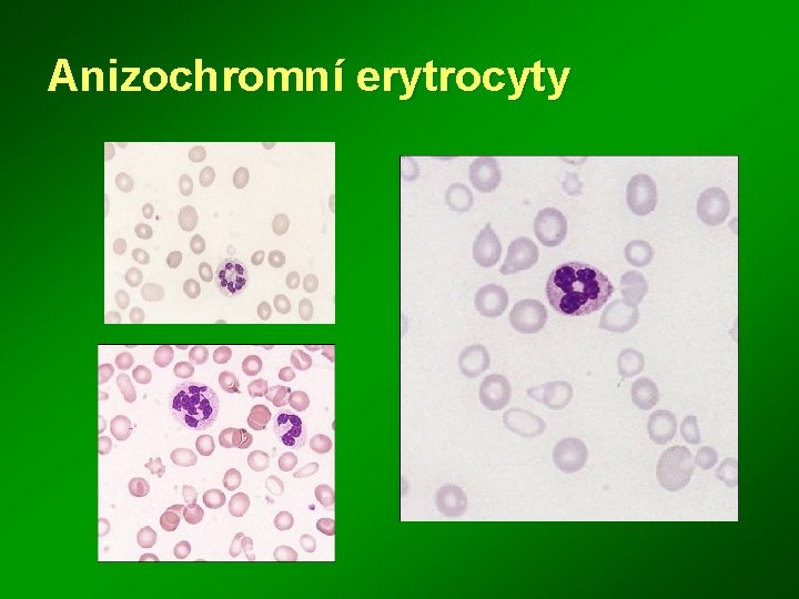 Morfologie erytrocyt Bourkov L Matkov M Hoblov J
