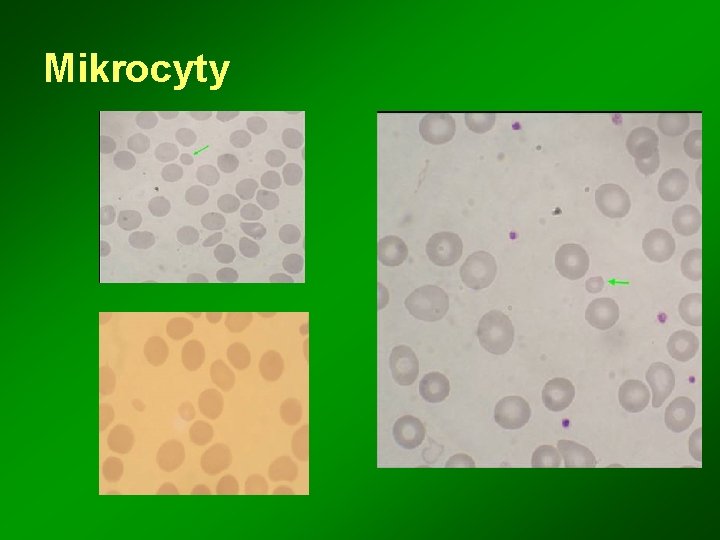 Morfologie erytrocyt Bourkov L Matkov M Hoblov J