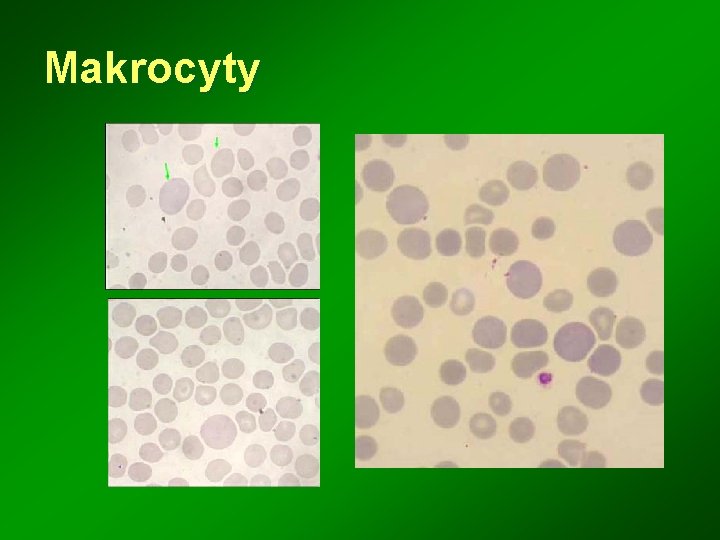 Morfologie erytrocyt Bourkov L Matkov M Hoblov J