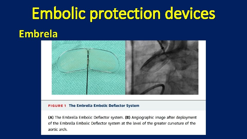 Embolic Protection Devices in Transcatheter Aortic Valve Replacement