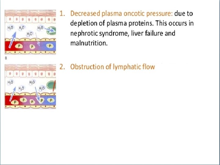APPROACH TO A CASE OF ANASARCA Presented By