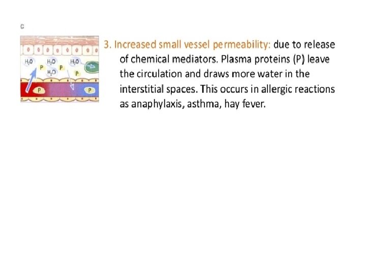 APPROACH TO A CASE OF ANASARCA Presented By