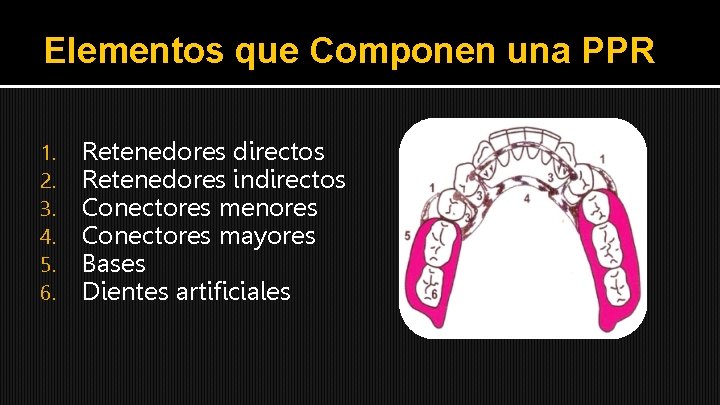 Componentes de una Dentadura Parcial Removible de Cromo
