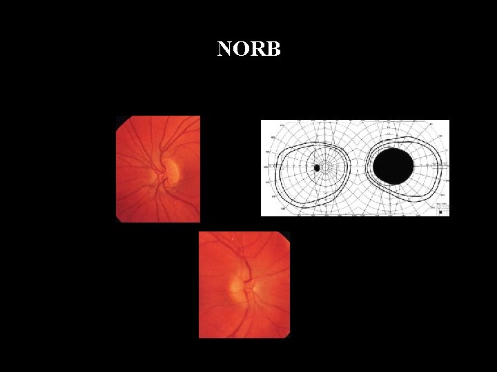 SEMIOLOGIE OPHTALMOLOGIQUE Dr MANIC Hlne INTERROGATOIRE Symptmes subjectifs