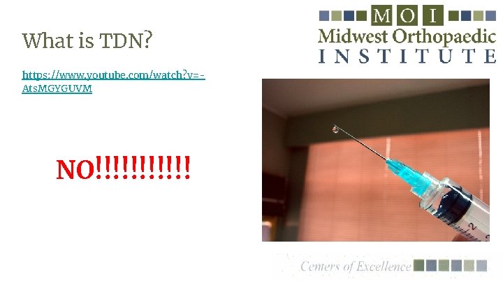 Trigger Point Dry Needling A Game Changer April