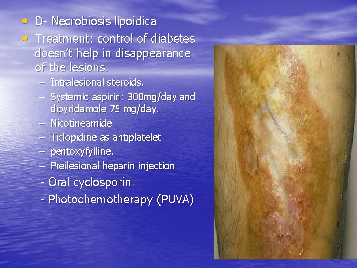 Dermatological Manifestations of Systemic Diseases By Dr saad