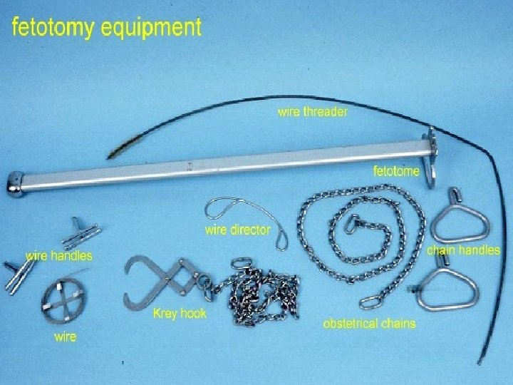 Fetotomy One of the most valuable obstetrical technique