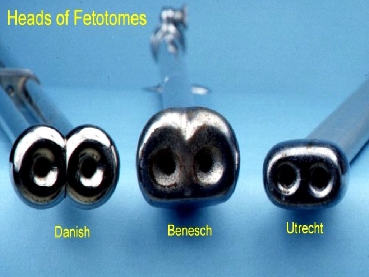 Fetotomy One of the most valuable obstetrical technique