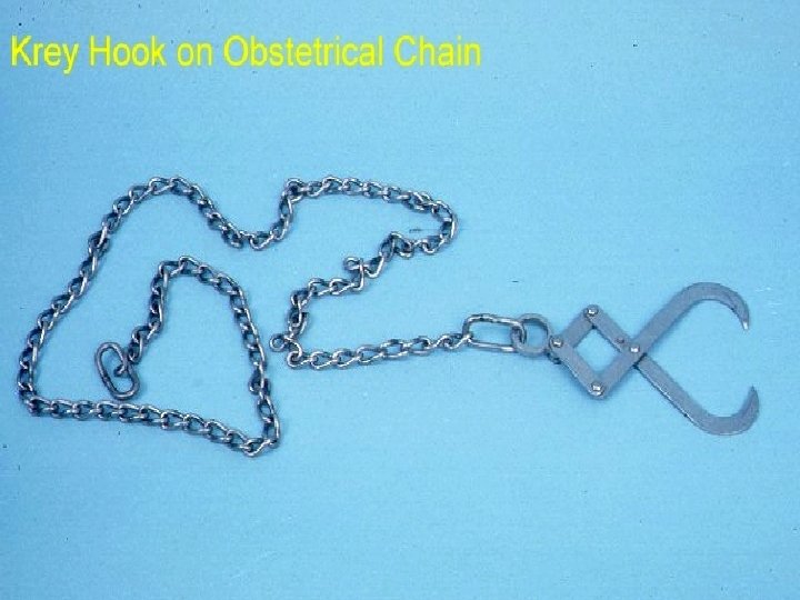 Fetotomy One of the most valuable obstetrical technique