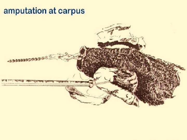 Fetotomy One of the most valuable obstetrical technique