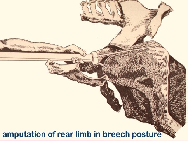 Fetotomy One of the most valuable obstetrical technique