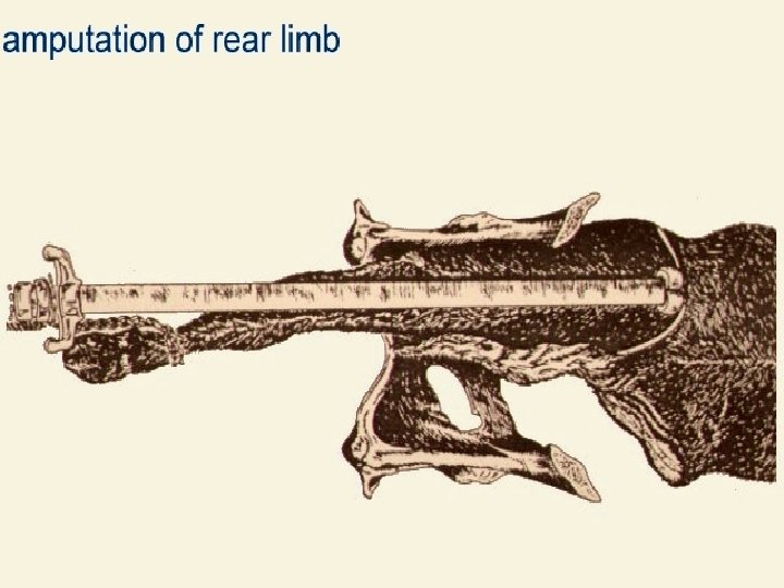 Fetotomy One of the most valuable obstetrical technique