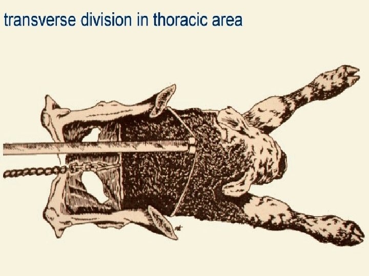 Fetotomy One of the most valuable obstetrical technique