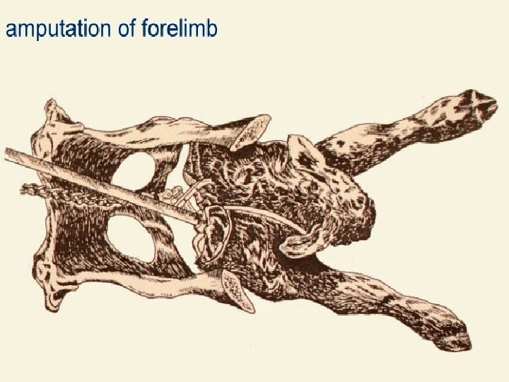 Fetotomy One of the most valuable obstetrical technique