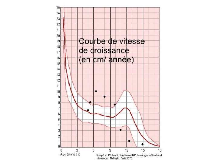 PUBERTE NORMALE ET PATHOLOGIQUE Smiologie des caractres sexuels