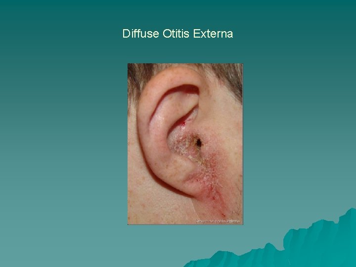 External Ear Diseases DR MONA AHMED ARAHIM ENT