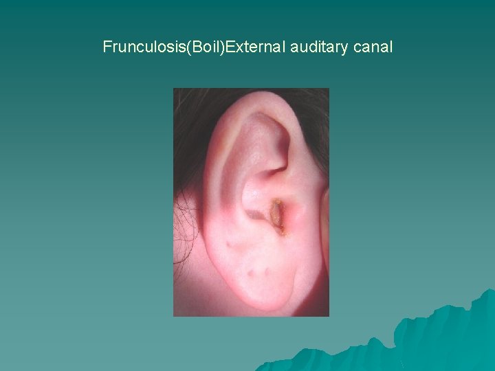 External Ear Diseases DR MONA AHMED ARAHIM ENT