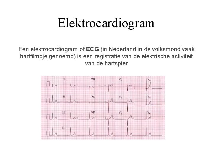 Maken van een 12 afleidingen ECG Leerdoelen Aan