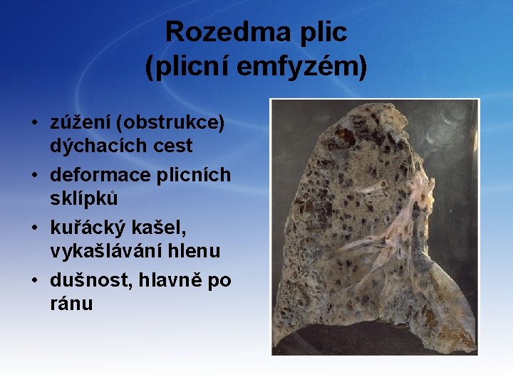 Choroby dchac soustavy Funkce plic Mechanick thorakln porann