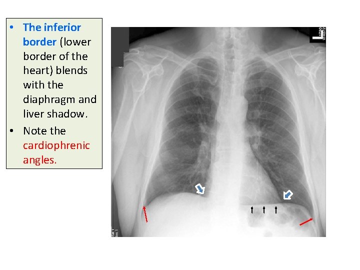 Radiological Anatomy of Thorax Dr Jamila Elmedany Prof