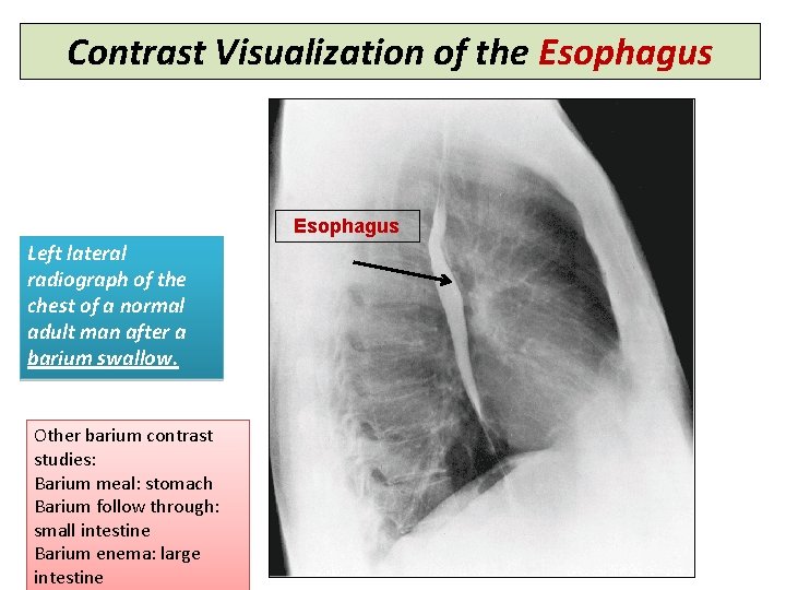 Radiological Anatomy of Thorax Dr Jamila Elmedany Prof
