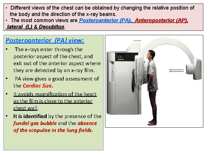 Radiological Anatomy of Thorax Dr Jamila Elmedany Prof