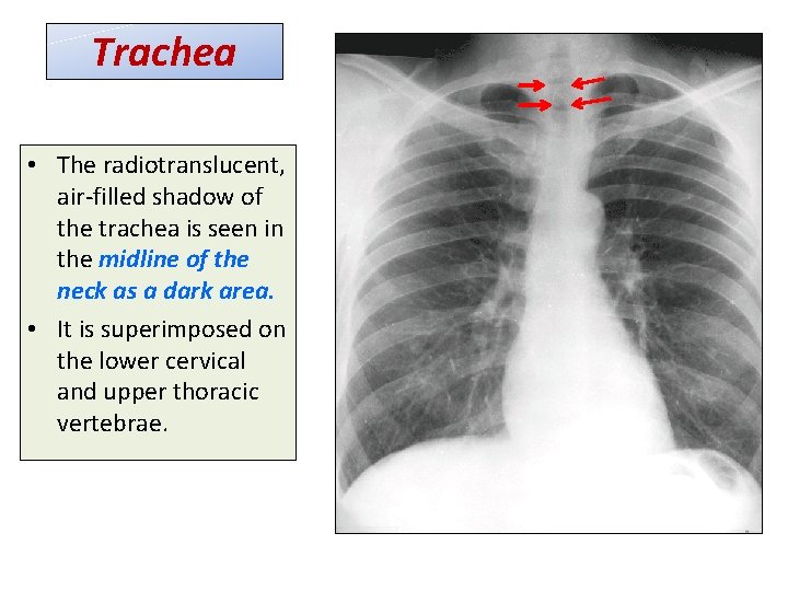 Radiological Anatomy of Thorax Dr Jamila Elmedany Prof