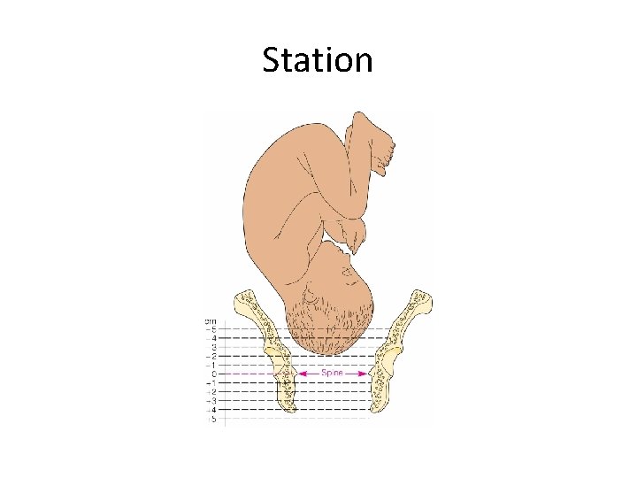 Intrapartal Nursing Care Labor and Birth Linda L