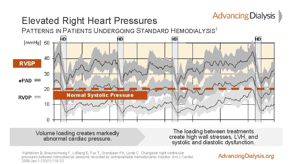 Better Management of Volume with Intensive Hemodialysis STRIKING