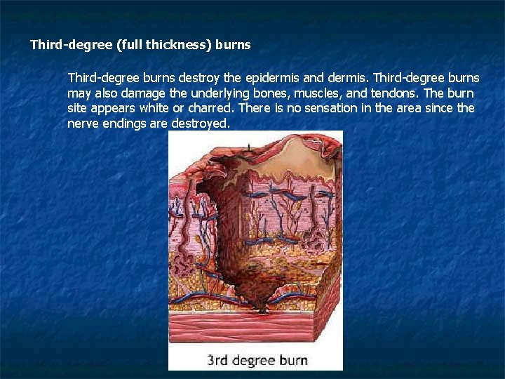 Activity 5 1 2 Burn Unit Treatment Options