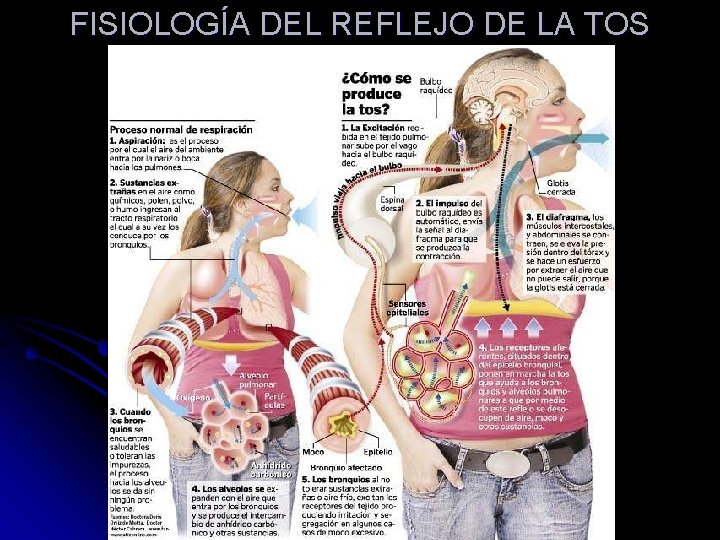 MANEJO DE SINTOMAS RESPIRATORIOS DISNEA y TOS DR