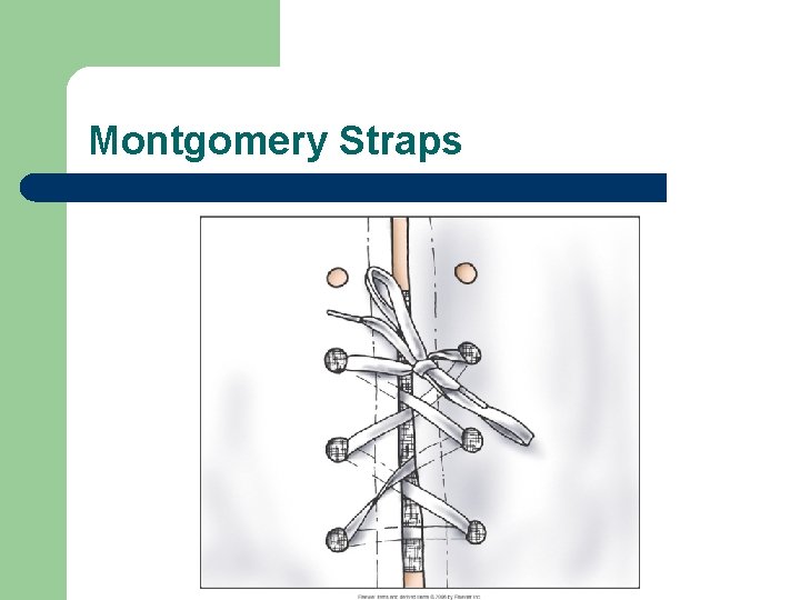 The Intraoperative Patient By Lisa M Dunn RN